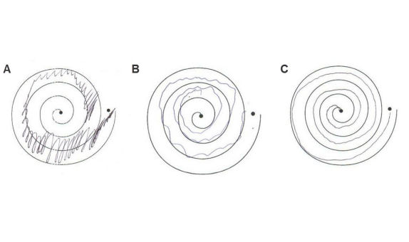 Rambam Health Care Campus - Focused Ultrasound